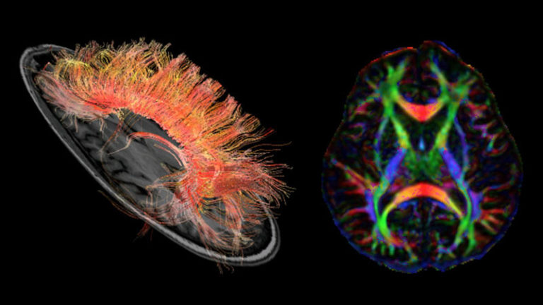 DTI Information for Providers | University Medical Imaging